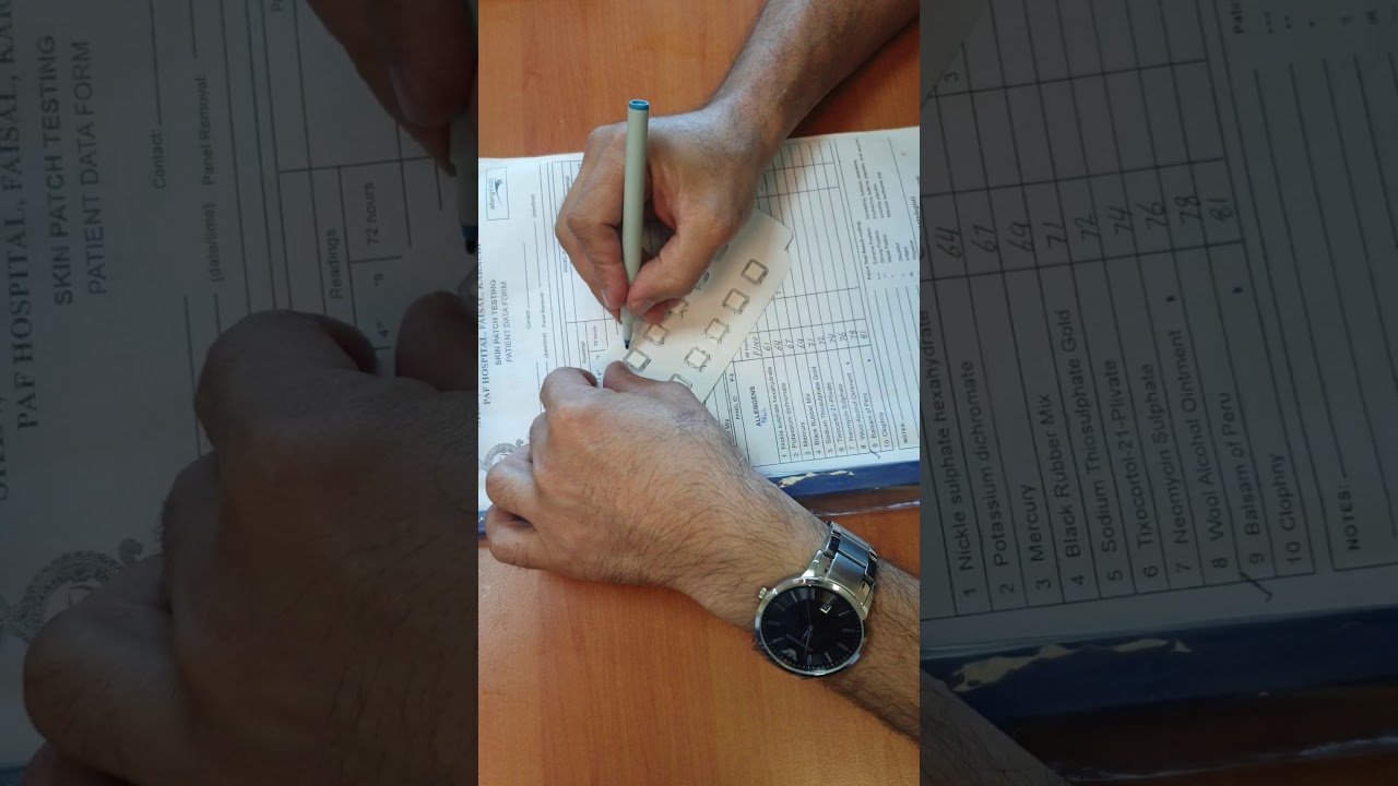 Demo-8: Patch testing