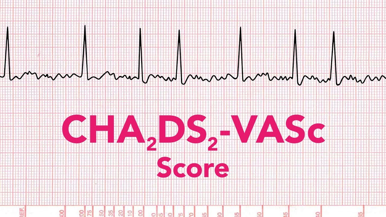 CHADS-VASc Score for Atrial Fibrillation - MEDZCOOL