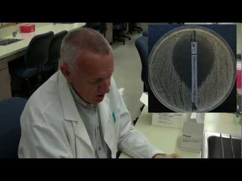 Etest for antibiotic susceptibility
