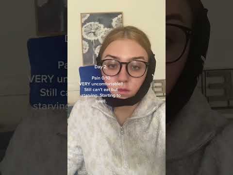 Struggled but Survived Wisdom Teeth Removal #wisdomteeth #dentalphobia