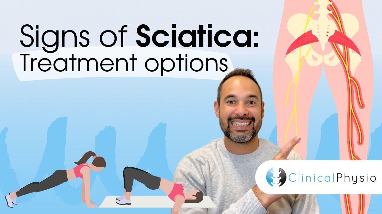 Sciatica Treatment Options | Expert Physio Guide