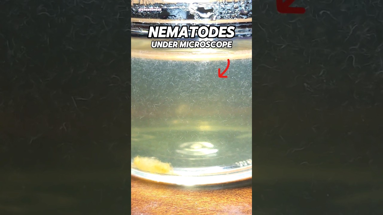 Nematodes Under A Microscope (Worms)