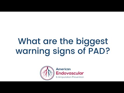 What are the biggest warning signs of PAD?