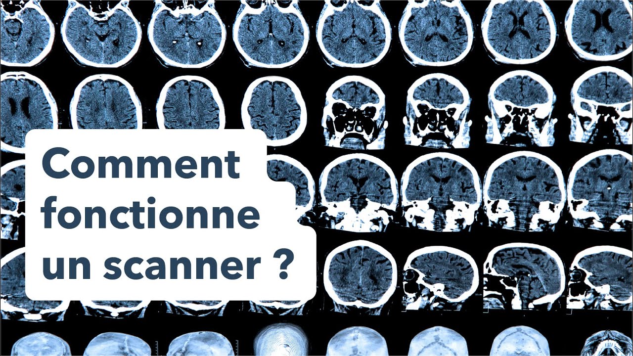 IMAGERIE MEDICALE #2 : Le scanner