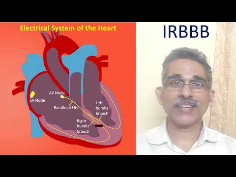 What is IRBBB?