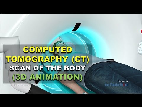 WHAT IS COMPUTERIZED TOMOGRAPHY (CT)? | (THE BEST EXPLAINED!!)