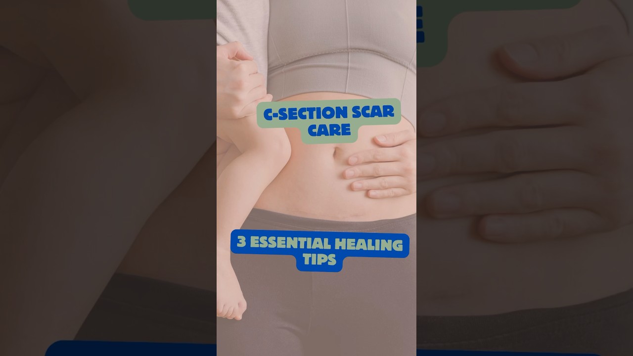✨ C-Section Scar Care Made Simple: 3 Must-Know Tips! ✨