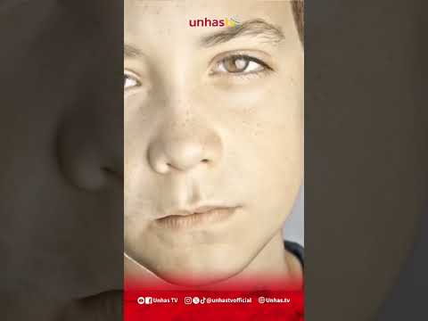Bullying di Binus School Serpong: Polisi Tetapkan Anak sebagai Tersangka dan Berkonflik dengan Hukum
