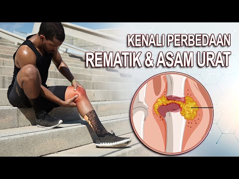 KENALI PERBEDAAN REMATIK DAN ASAM URAT