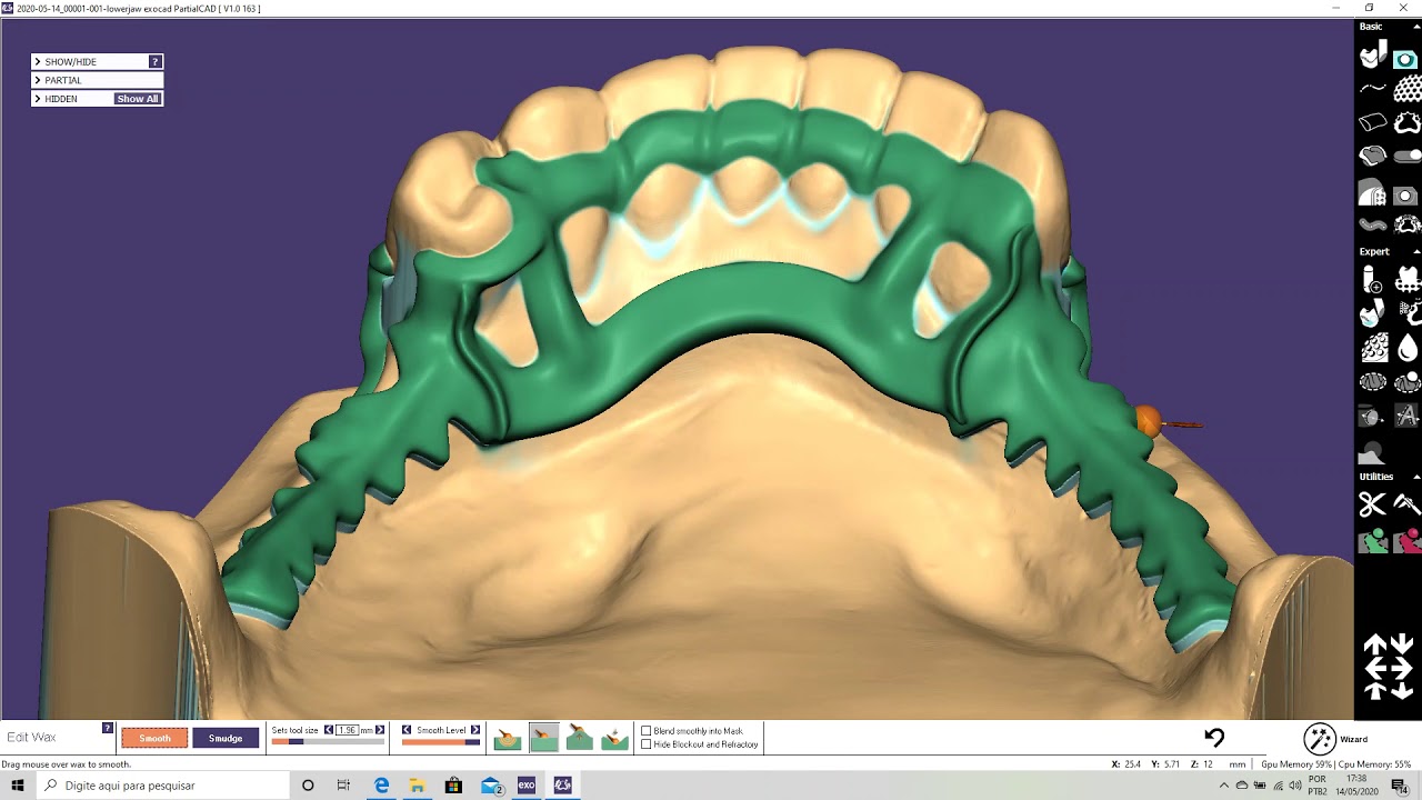 EXOCAD PARTIALCAD - PPR DIGITAL INFERIOR