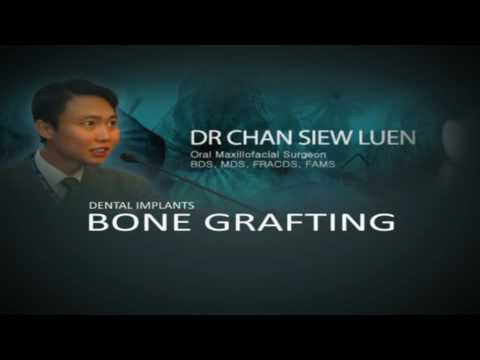 Sunken Jaw? How We Can Rebuild A Jaw for Dental Implant using Bone Grafting