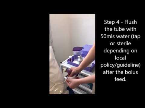 Bolus feeding video by FHFT