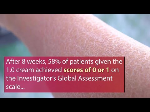 Novel atopic dermatitis cream shows promise in phase 2 study