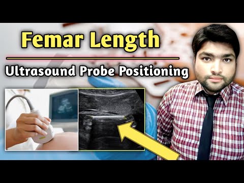 Femur Length Ultrasound | The Complete Guide to Probe Positioning for Accurate Fetal Growth