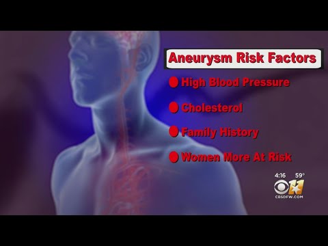 The Ones For Wellness: A Look At Brain Aneurysms
