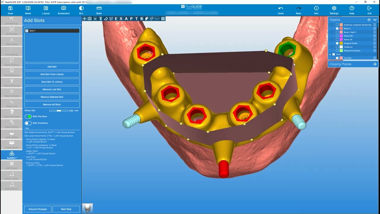 RealGUIDE Software: Stackable