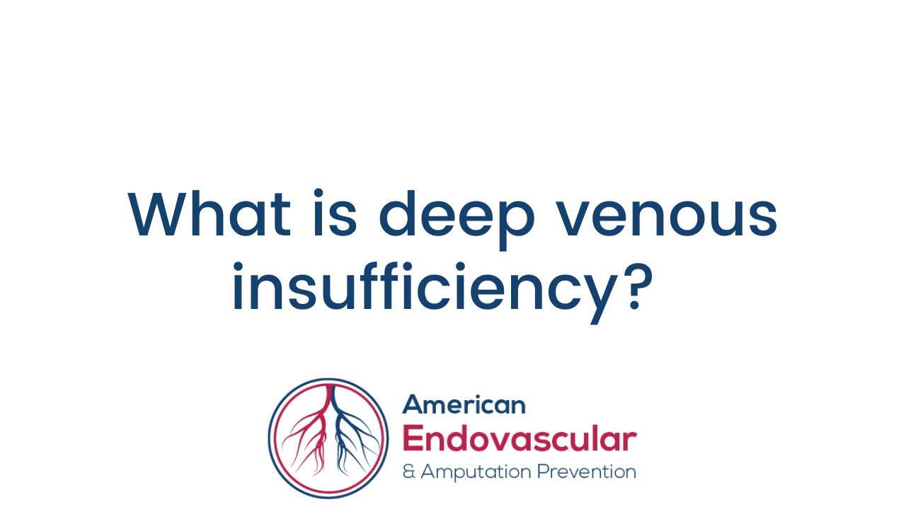 What is deep Venous Insufficiency?