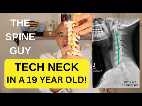5 Exercises to maintain your cervical spine to prevent neck surgery!