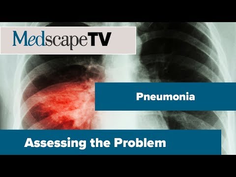 Assessing the Problem | Community-Acquired Pneumonia | MedscapeTV