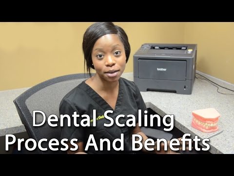 Dental Scaling Process And Benefits