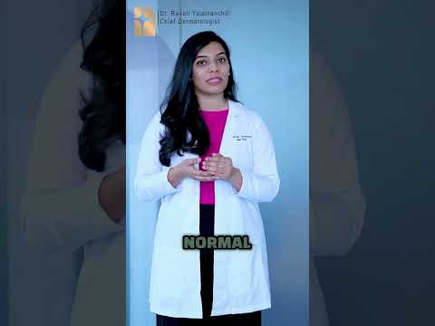 Top Dermat Dr Ravali explains : Keloid vs. Hypertrophic Scars: What's the Difference