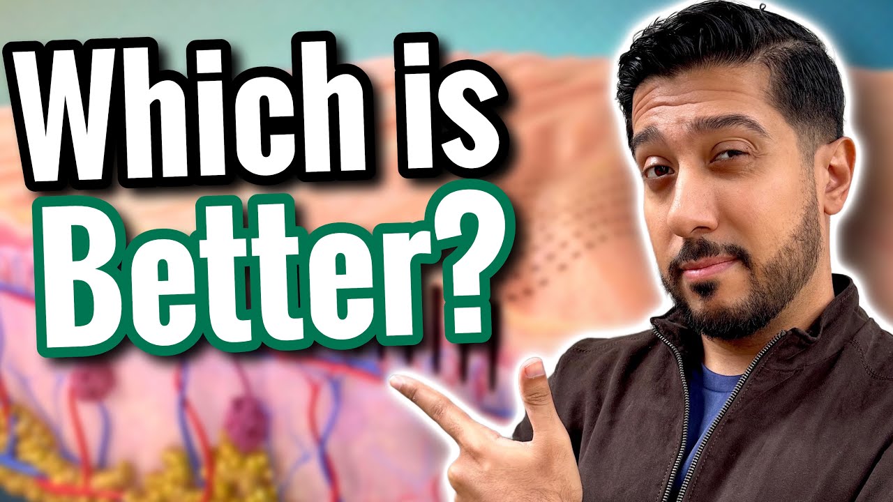 Microneedling vs Lasers | Which One is Right for You?