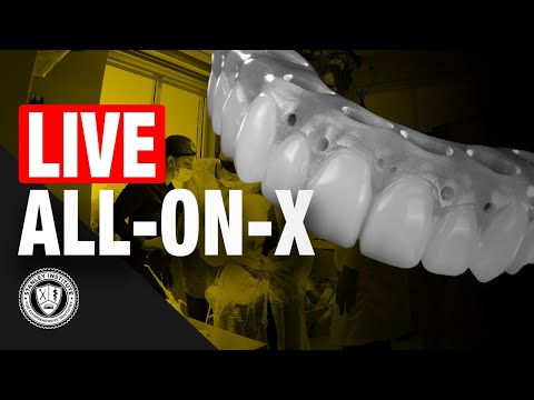 LIVE ALL-ON-X Guided Procedure | Stanley Institute