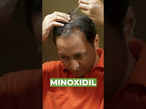 Dr. Agni, Dermatologist explains the real reason why minoxidil causes increased hair fall