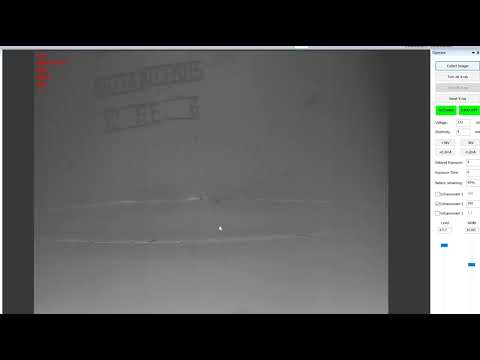 Portable DR NDT1013MA Image Quality