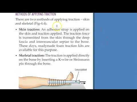 Orthopedics 047 Traction