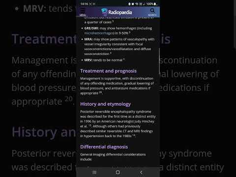 Neuroradiology - Posterior Reversible Encephalopathy Syndrome - PRES