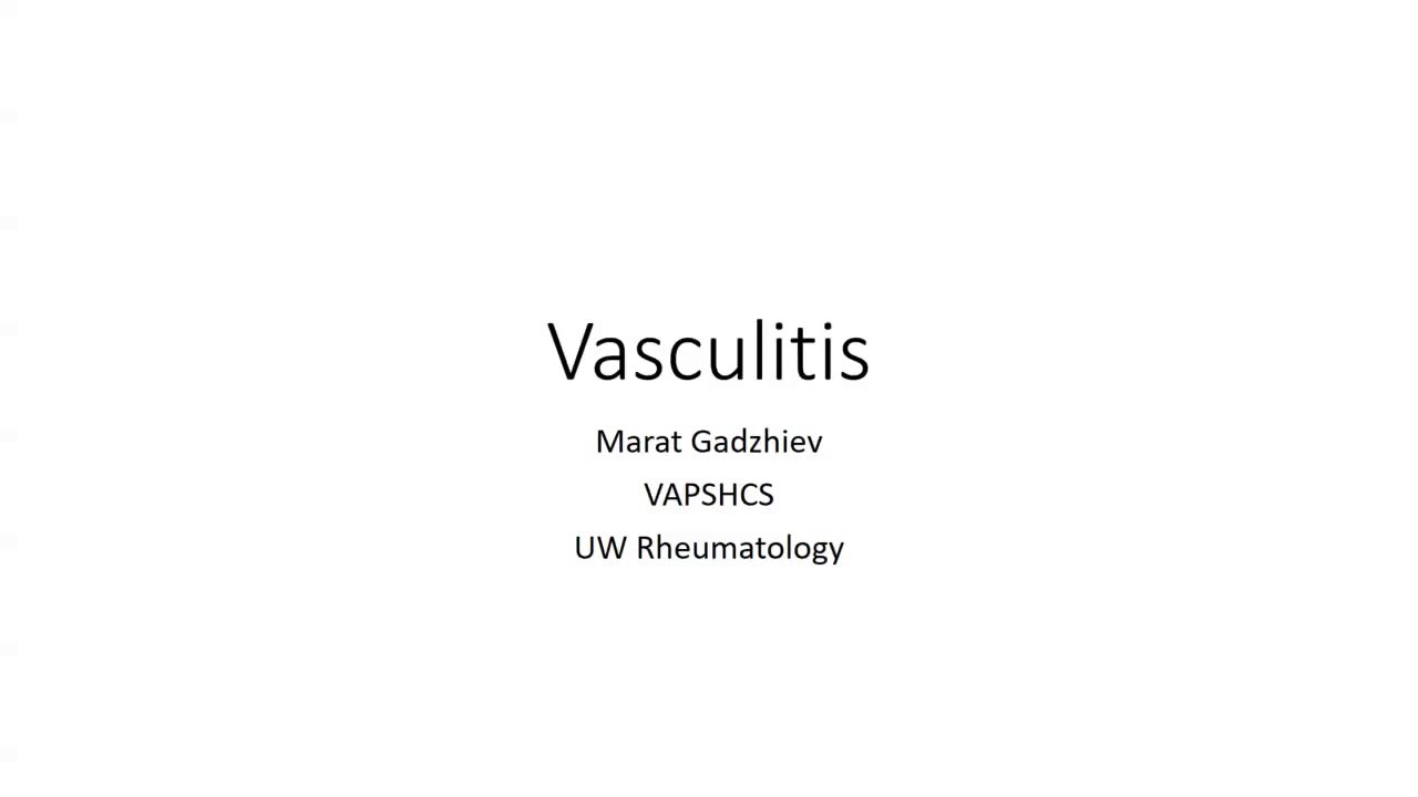 04/30/2019 Vasculitis