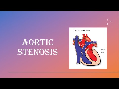 Aortic stenosis - definition, clinical features, investigation, treatment