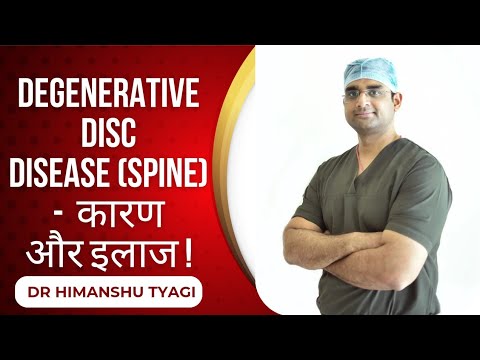Degenerative Disc Disease in Spine - कारण और इलाज ! | Dr. Himanshu Tyagi