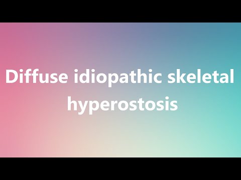 Diffuse idiopathic skeletal hyperostosis - Medical Definition and Pronunciation