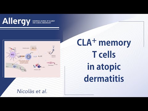 CLA+ memory T cells in atopic dermatitis.