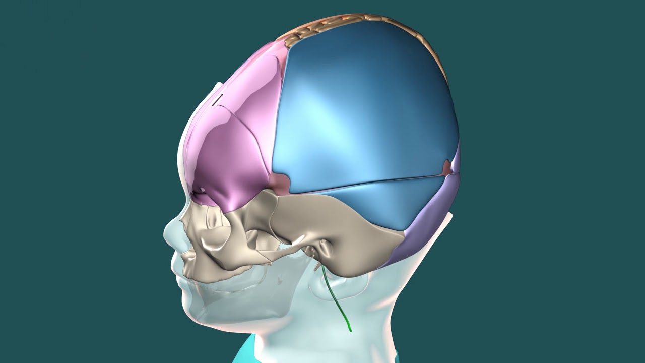 Hydrocephalus Repair