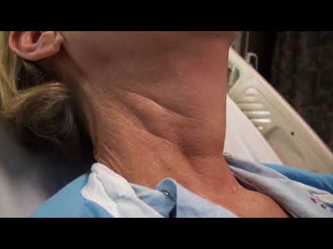 Regular Carotid Pulsation and Discernible Internal Jugular Venous Pulse