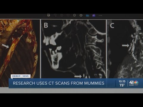 KSHB | New Research Looks at CT Scans of Mummies