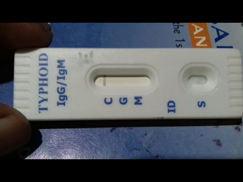 Typhoid Test Kit - Widal Test Kit Latest Price, Manufacturers & Suppliers