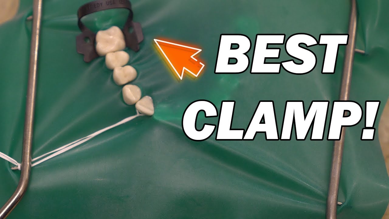 Top 5 Rubber Dam Tips!