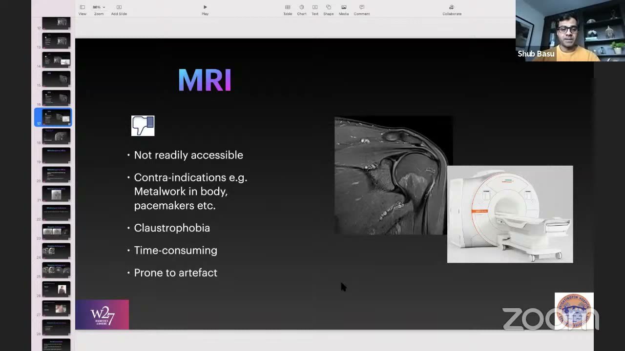 MSK Radiology for Upper Limb Conditions