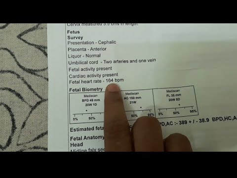 my Baby Boy complete scanning reports|baby ultrasound|gender|heart rate|placenta position