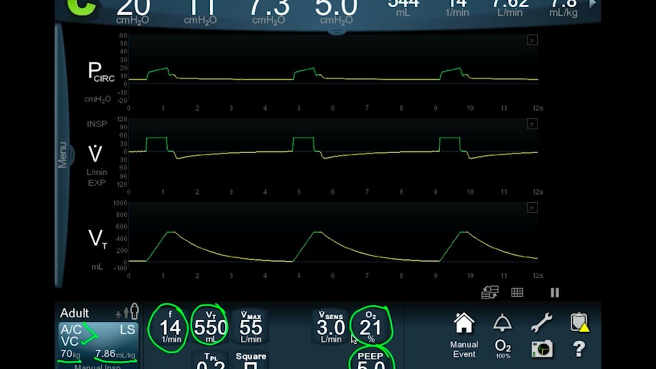 Vent Modes 101! Focus on the Waveform -- BAVLS