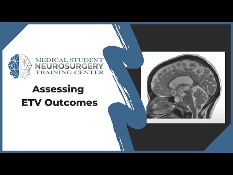 Assessing ETV Outcomes