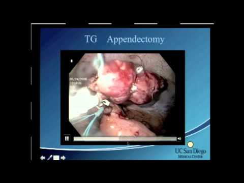 SS14 Plenary Session II: S084 BROAD CLINICAL UTILIZATION OF NOTES. IS IT SAFE ?