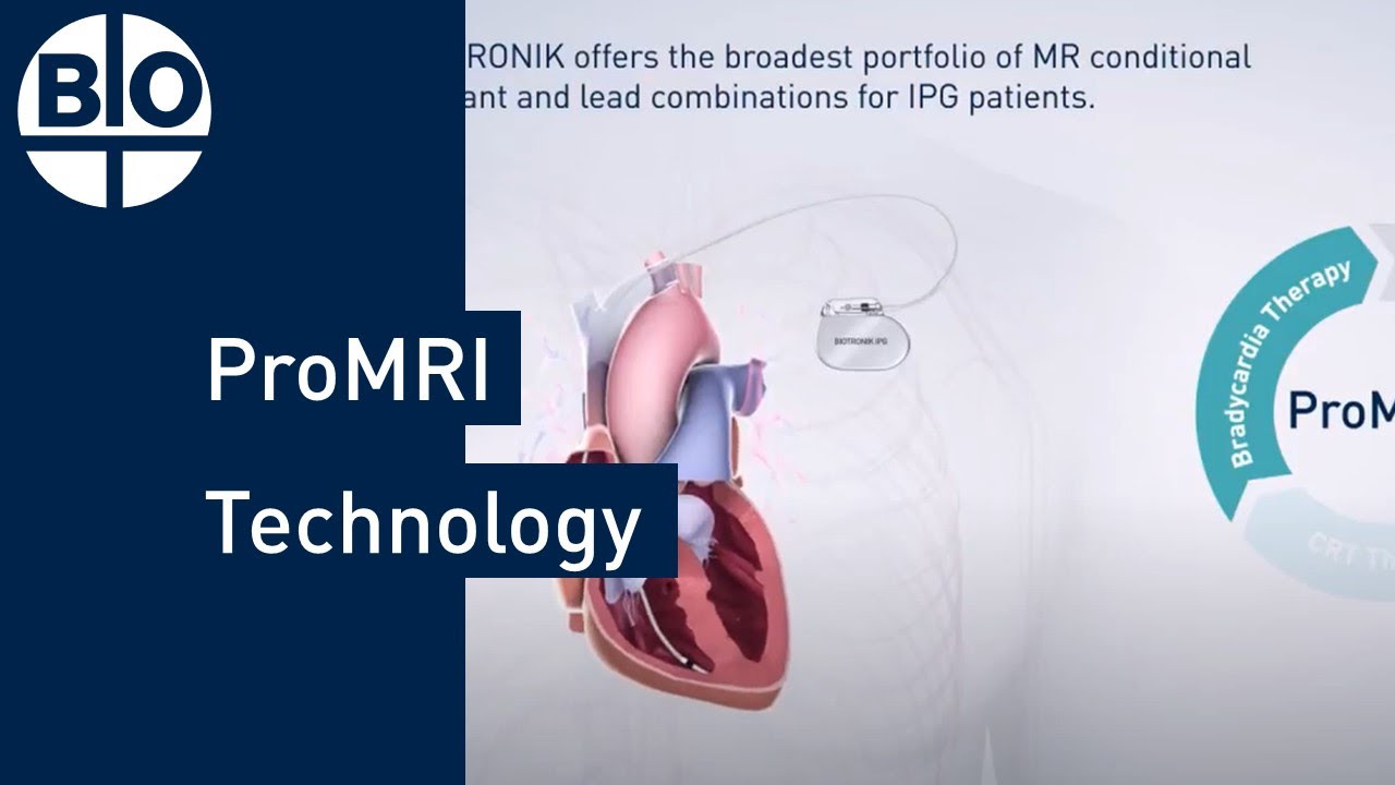 Introducing ProMRI Technology: The Complete MR Conditional System Portfolio