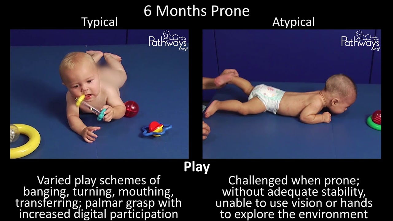 6 Month Old Baby Typical & Atypical Development Side by Side