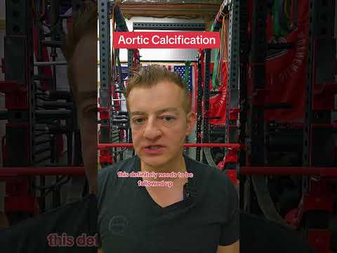 What to do about Aortic calcification? #aorta #calcium #heartdisease