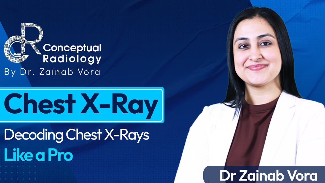Mastering Chest X-Ray Interpretation: A Comprehensive Guide with Dr ...